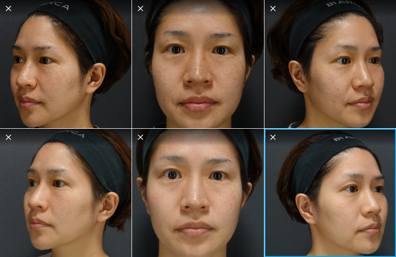 Beyond the Laser: Cosmetic Surgery and Pigmentation Treatment ...